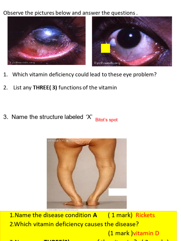 CHARTS and OSPE With Answers -Biochemistry -IMCH 2 | PDF | Medical Specialties | Diseases And ...