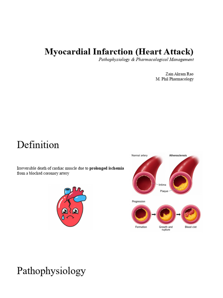 Myocardial Infarction (Heart Attack) | PDF