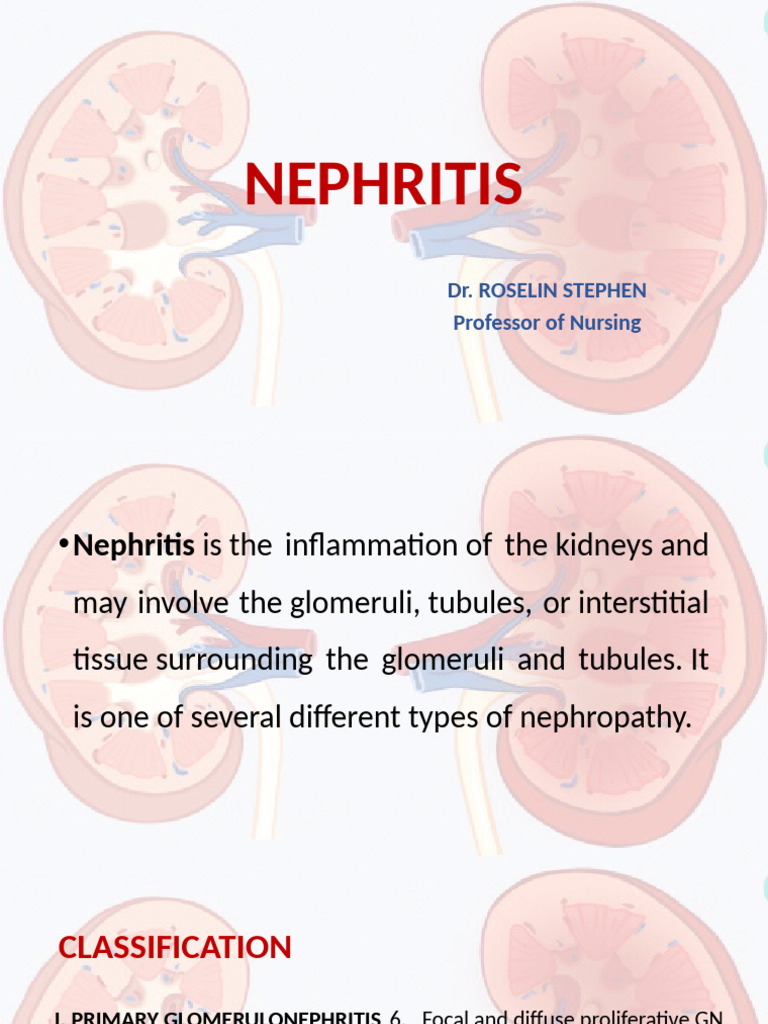 Understanding Nephritis Types and Causes | PDF | Immune System ...