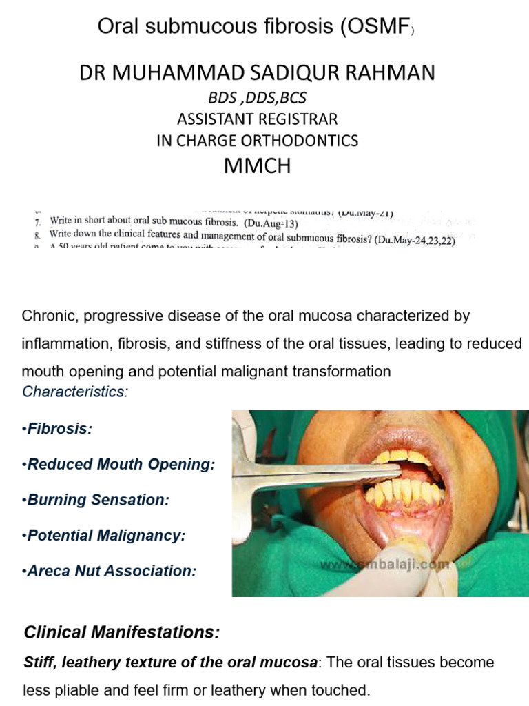 OSMF: Stages and Treatment Options | PDF | Diseases And Disorders ...