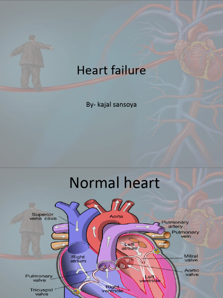 Understanding Heart Failure: Causes & Management | PDF | Heart Failure ...