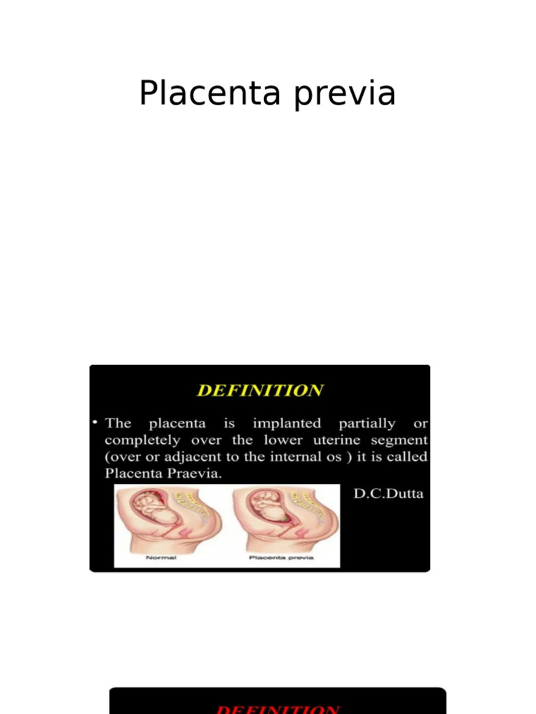 Placenta Previa | PDF