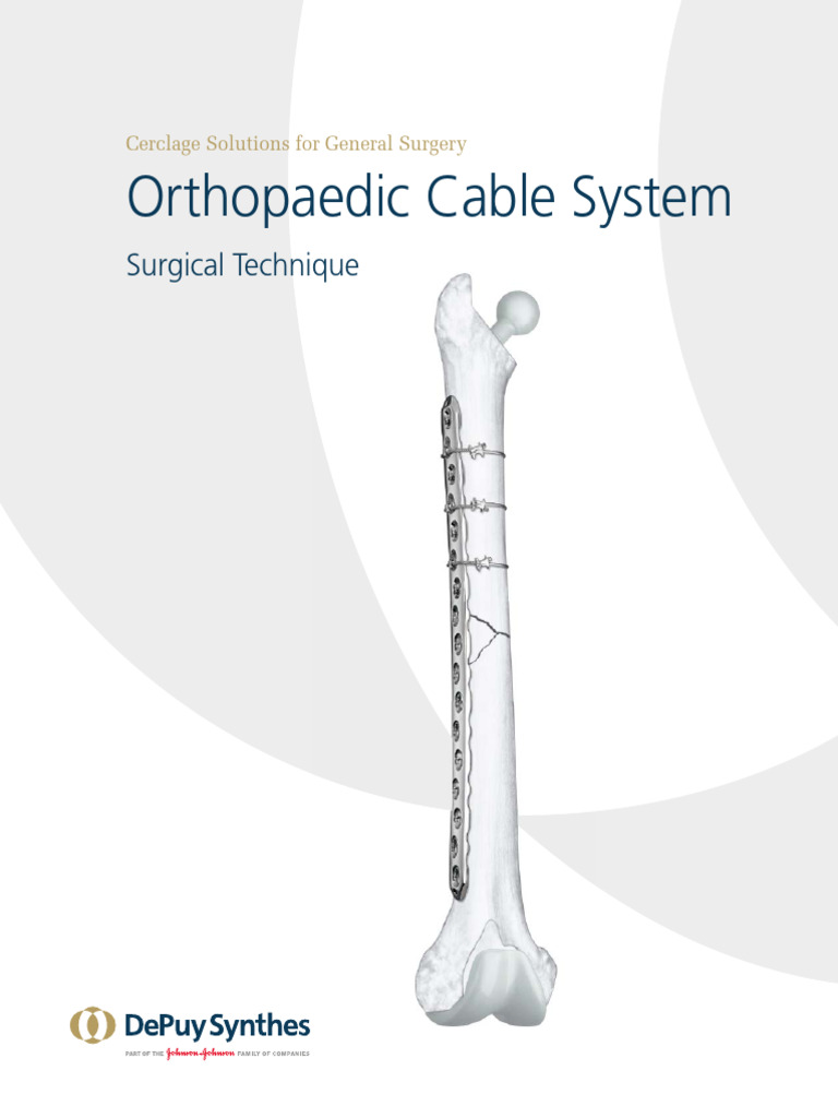 Orthopaedic Cable System Techniques | PDF