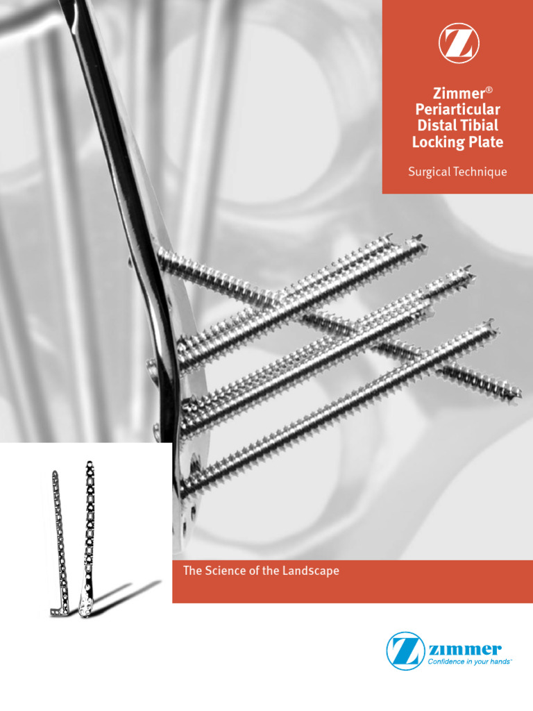 Zimmer Periarticular Distal Tibial Locking Plate Surgical Technique (97 ...