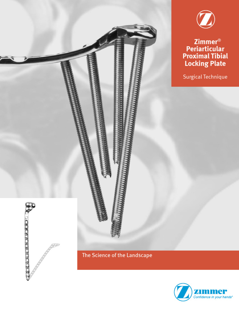 Zimmer Periarticular Proximal Tibial Locking Plate Surgical Technique ...