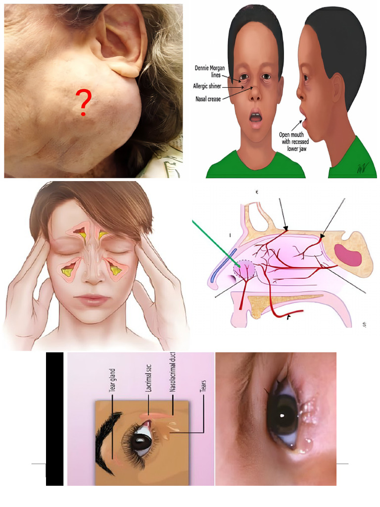 Head & Neck (DGP) Ospe | PDF