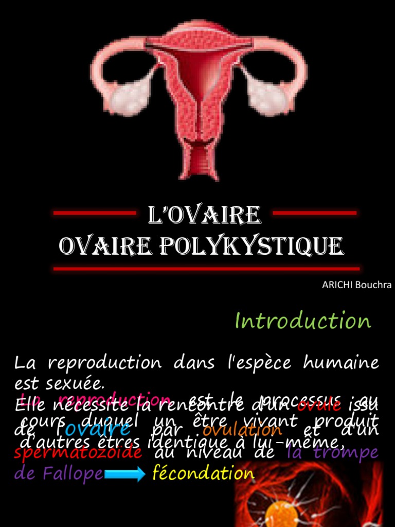 Syndrome des Ovaires Polykystiques : Causes et Traitements | PDF ...