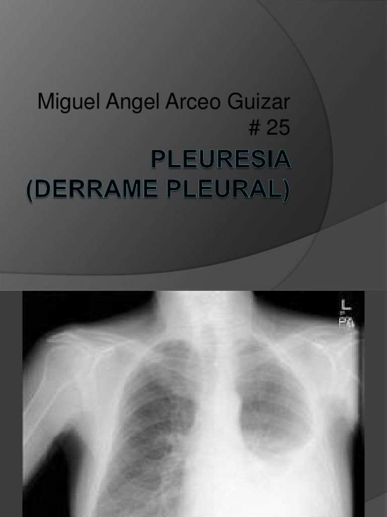 Pleuresia (Derrame Pleural) | PDF | Pecho | Tórax (anatomía humana)