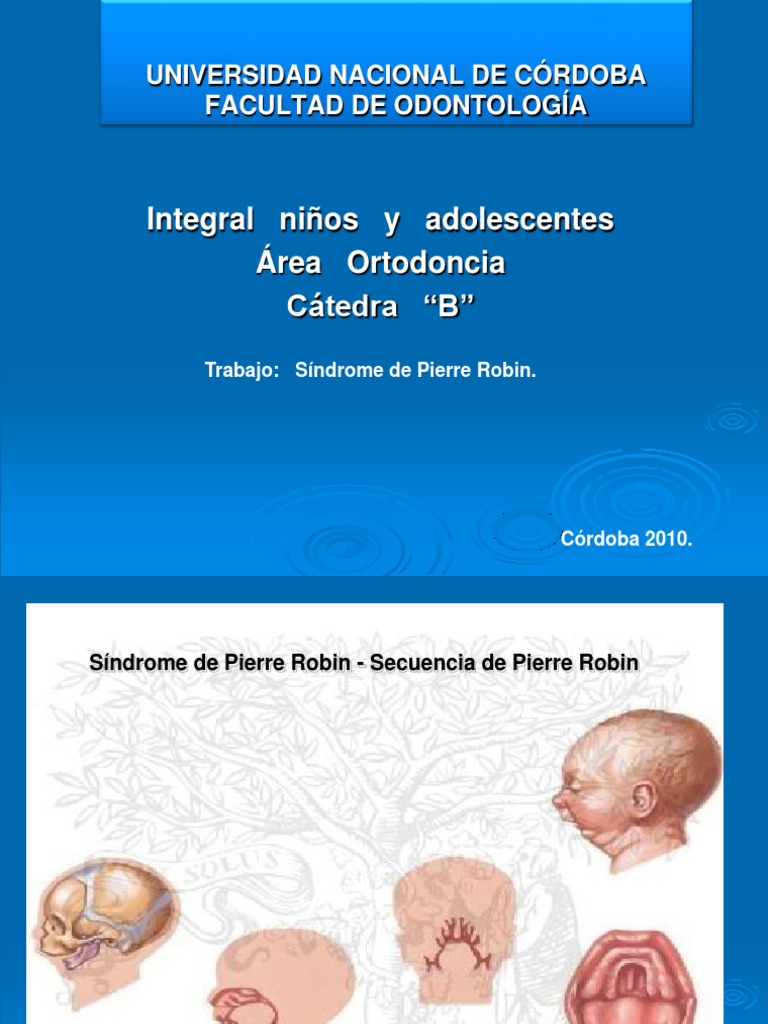 Sindrome Pierre Robin - 1 | PDF | Lengua | Amamantamiento
