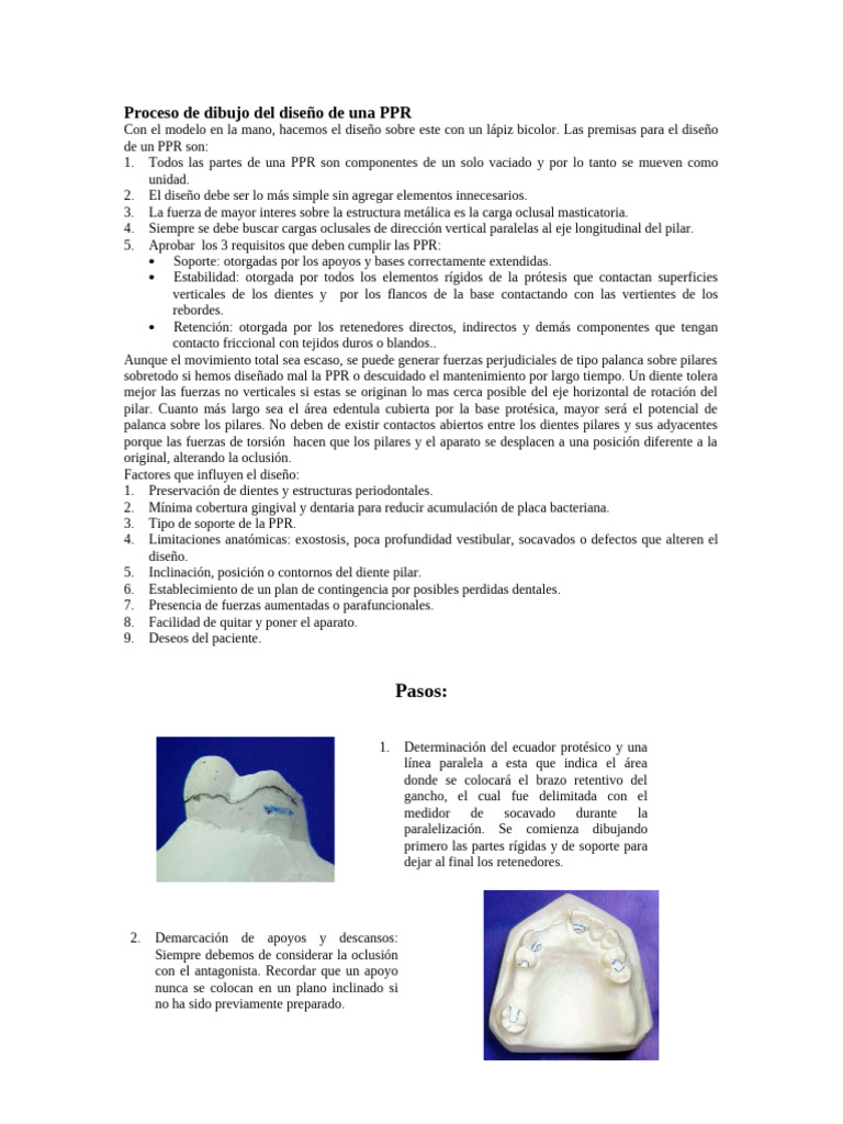 Diseño de PPR: Proceso de Dibujo | PDF | Odontología