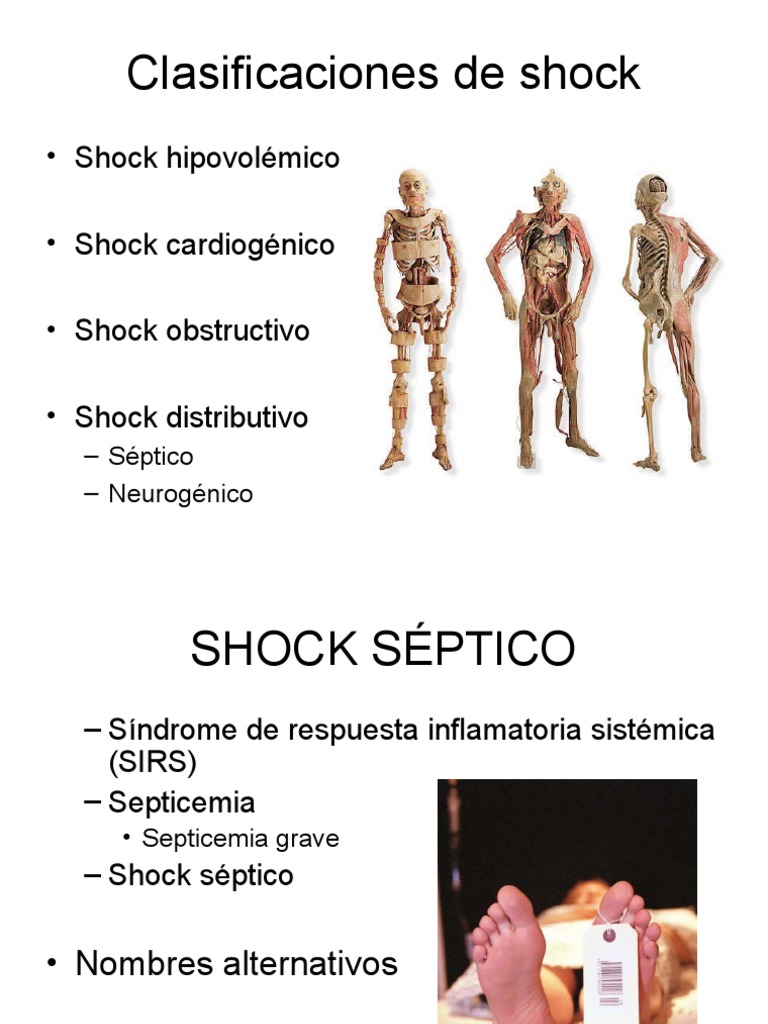 Shock Septico