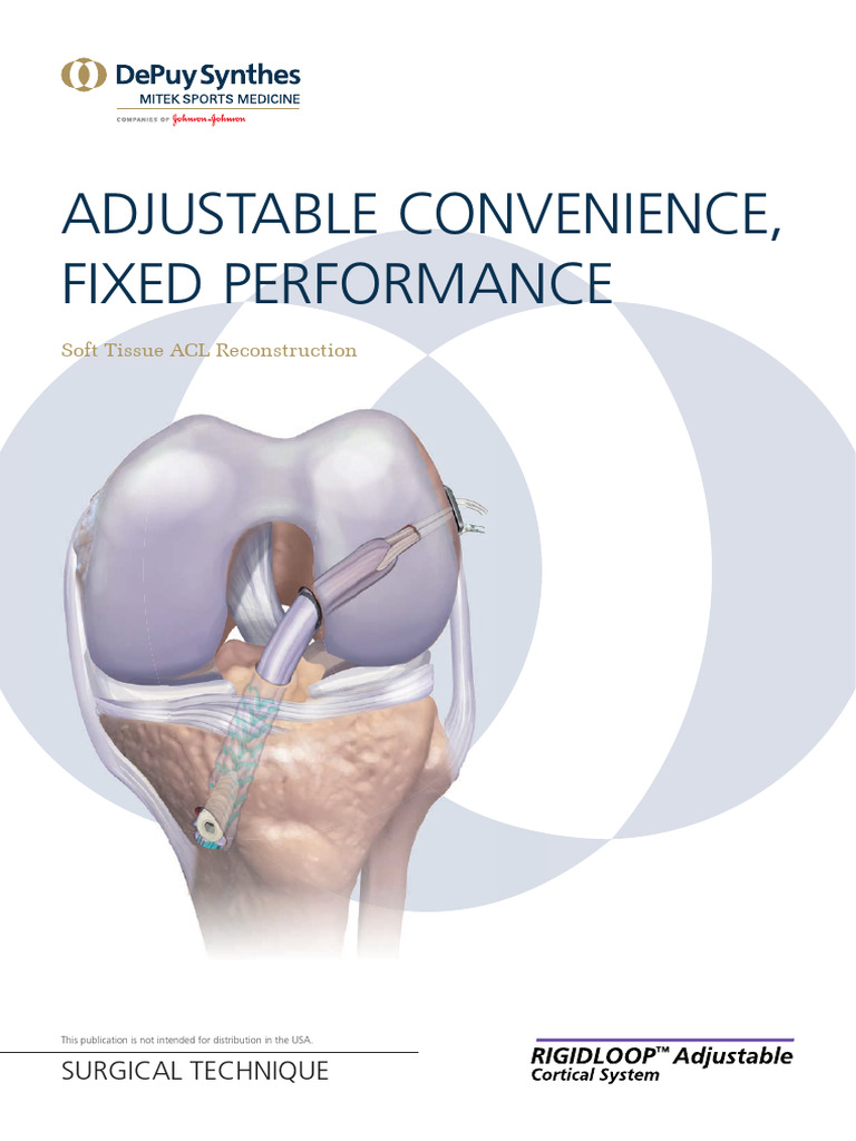 RigidLoop Adjustable Cortical System Guide | PDF | Orthopedic Surgery ...