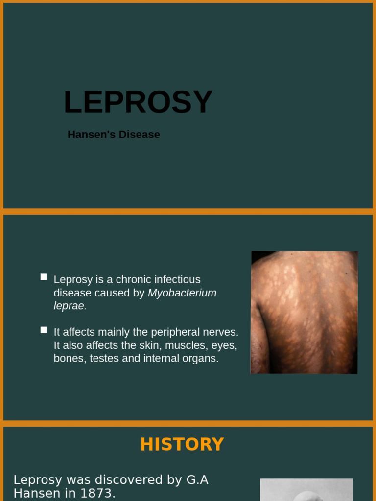 Understanding Leprosy: Causes and Classification | PDF | Leprosy ...