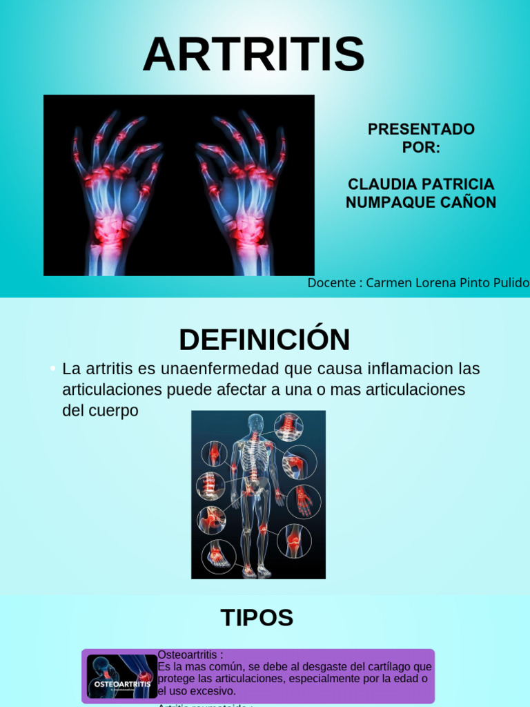 Presentación1.pptx 20250626 201251 0000.pdf 20250627 103047 0000 | PDF ...