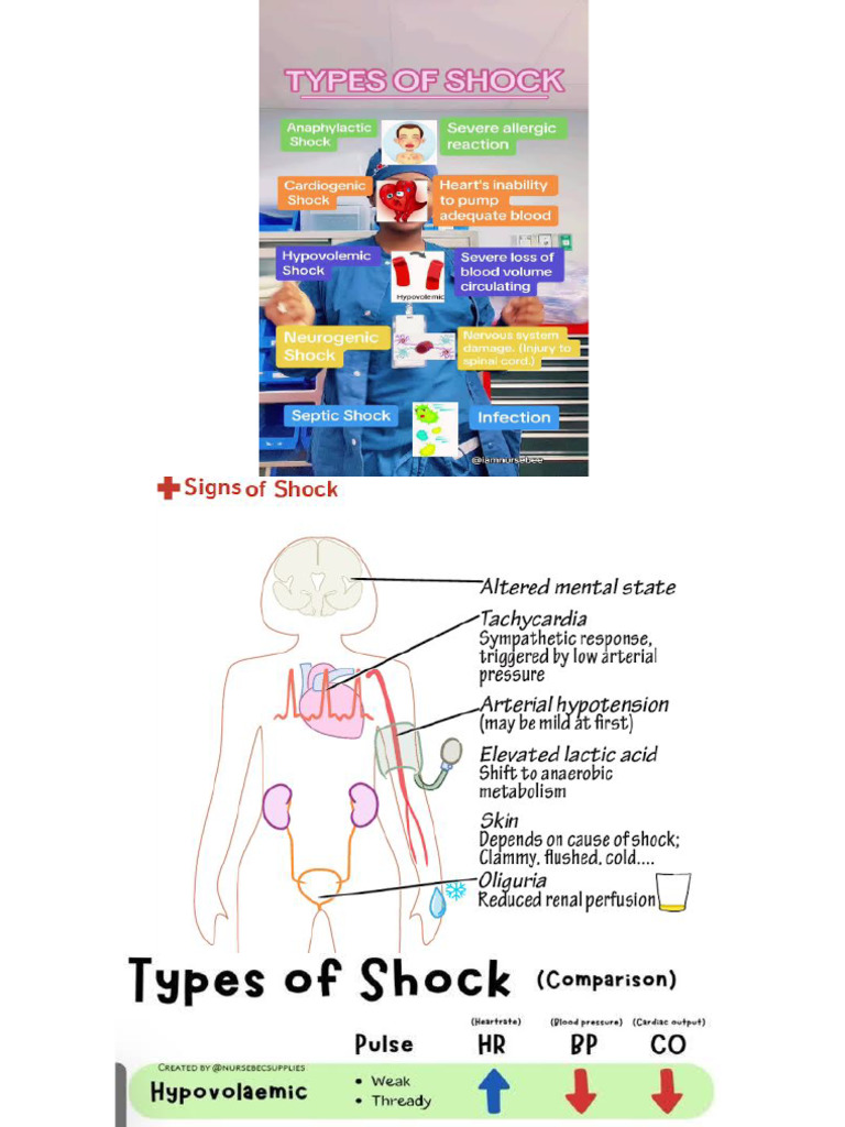 Shock Clinical Features | PDF