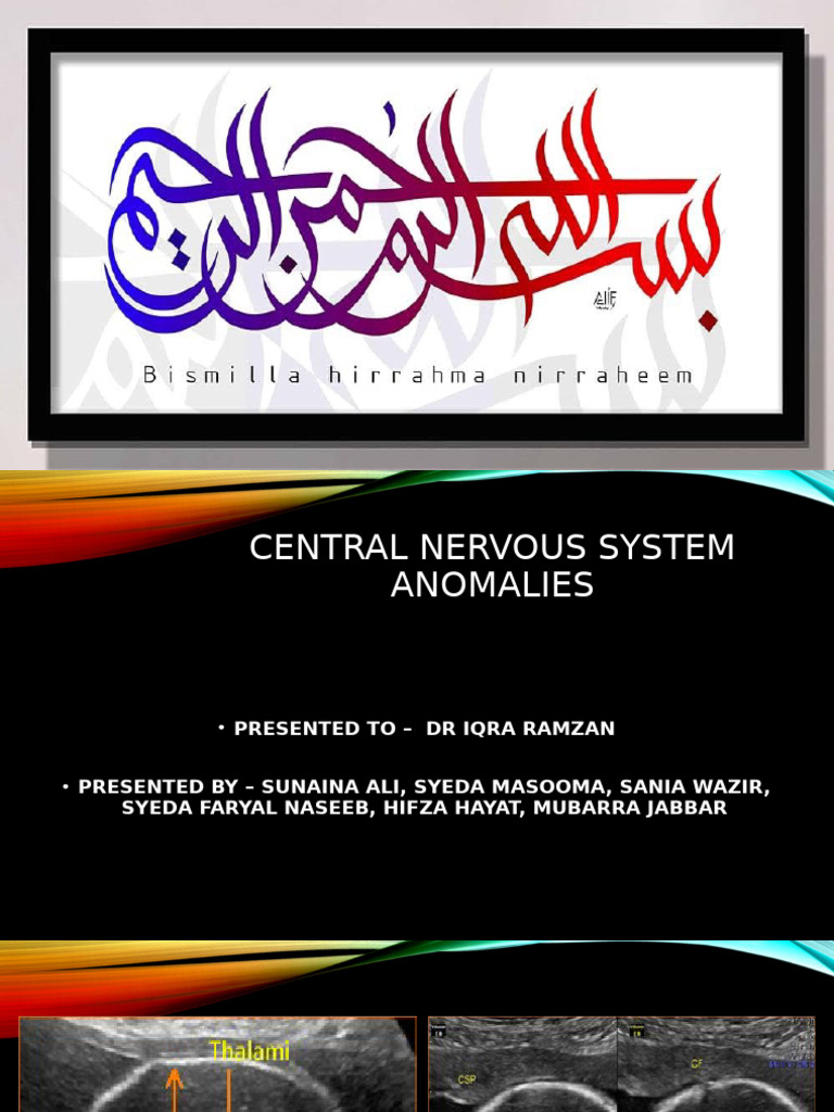 Atelencephaly and CNS Anomalies Overview | PDF | Nervous System ...