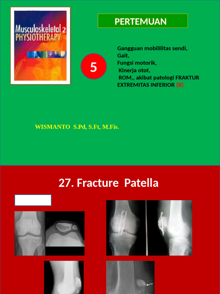 Fisioterapi Pasca Fraktur Patella | PDF | Anatomical Terms Of Motion ...