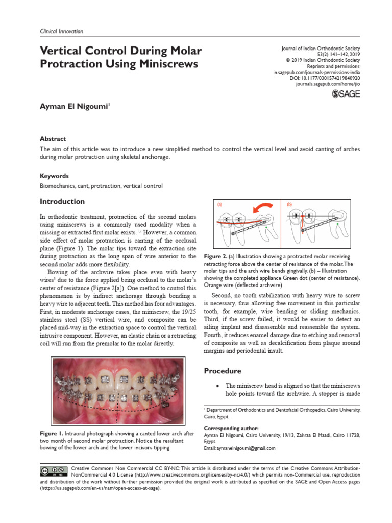Vertical Control in Molar Protraction | PDF | Orthodontics | Medical ...