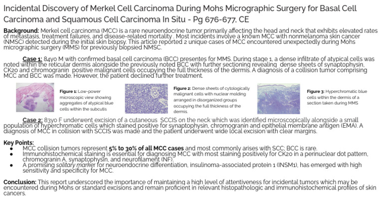 Incidental Discovery of Merkel Cell Carcinoma During Mohs - PG 676-677 ...