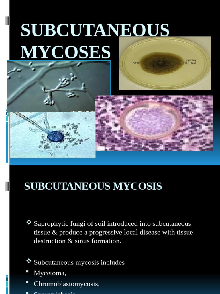 Overview of Subcutaneous Mycoses | PDF | Human Diseases And Disorders ...