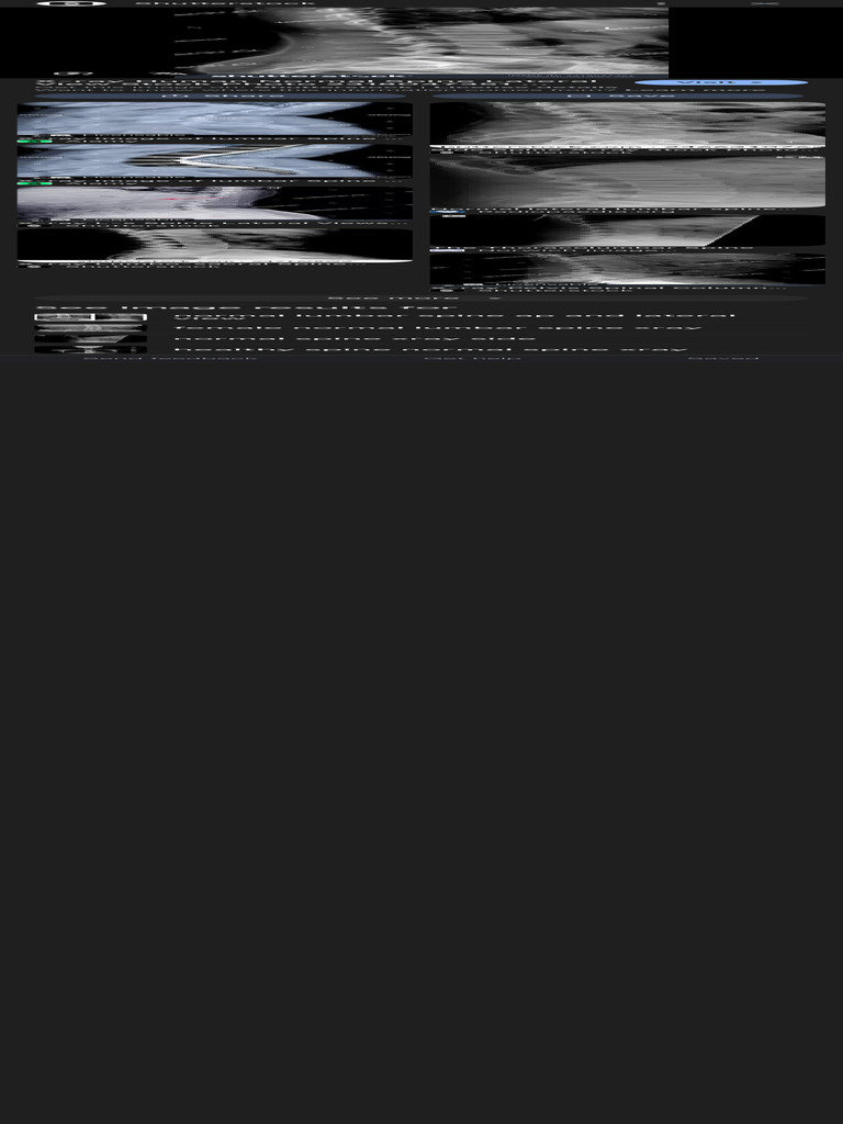 Normal Lateral Spine X-Ray Overview | PDF | Radiography | Radiology