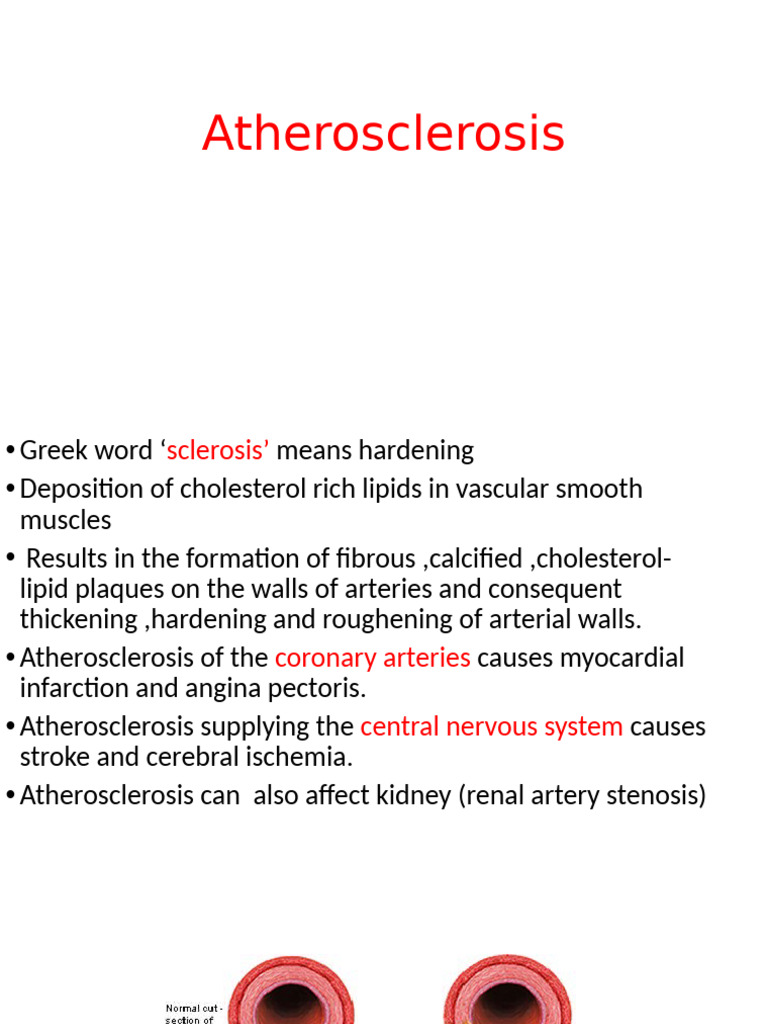 Atherosclerosis bio chy | PDF | Atherosclerosis | Artery