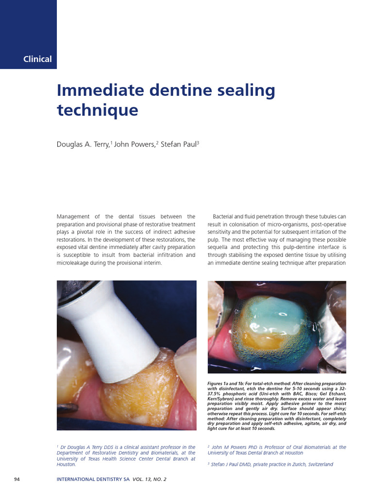 Immediate Dentin Sealing Techniques | PDF | Dentin | Materials