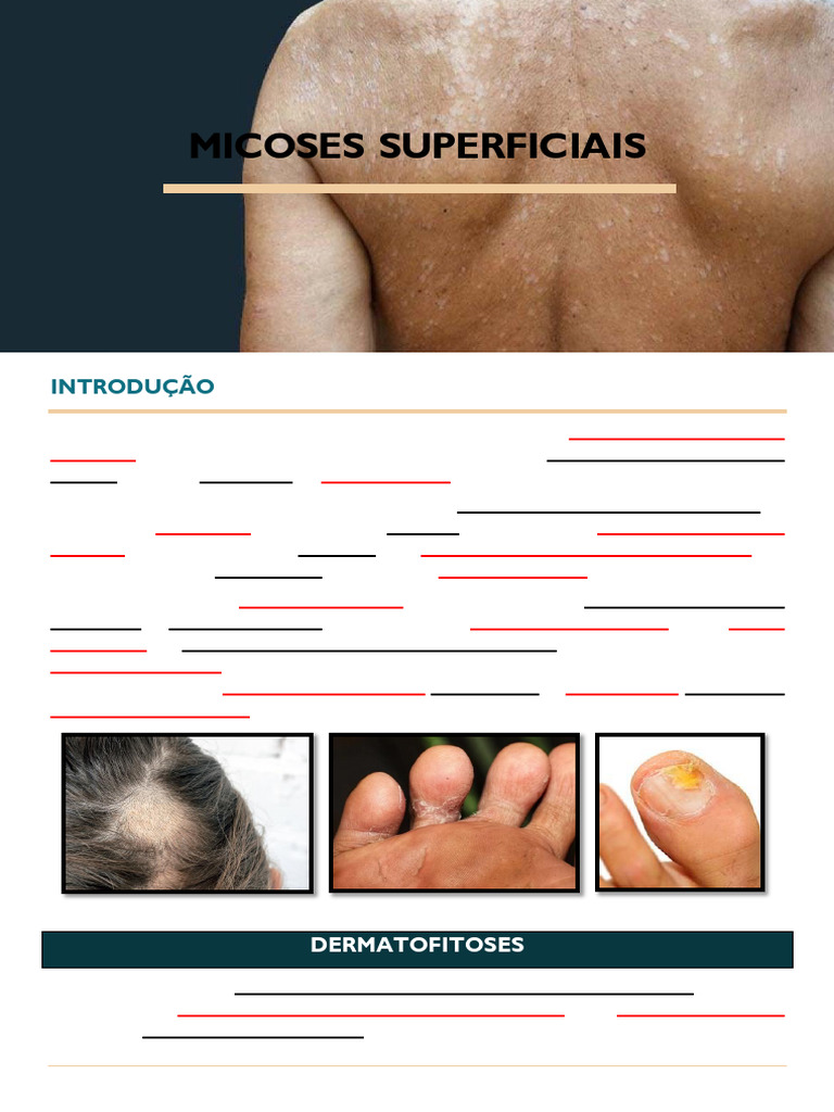 Micoses Fúngicas em Crianças: Diagnóstico e Tratamento | PDF ...