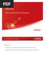 15 Lead ECG Placement Guide | PDF