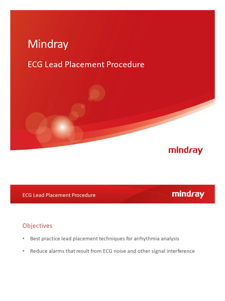 ECG Lead Placement Guidelines | PDF | Electrocardiography | Thorax