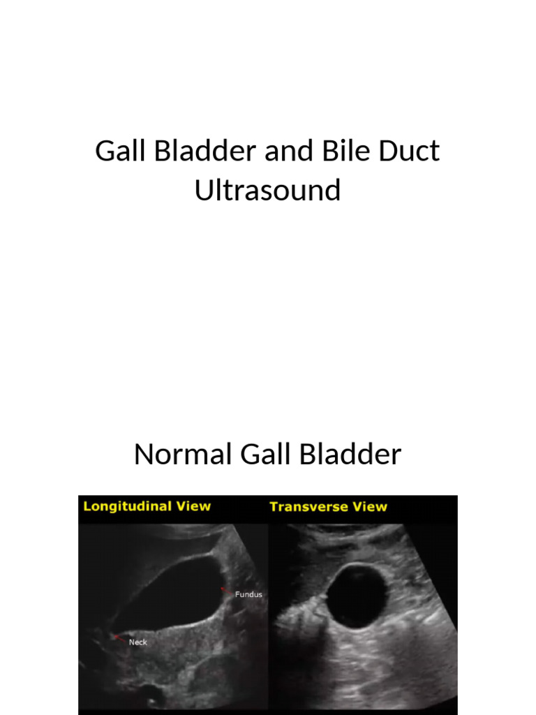 Gall Bladder & Bile Duct Ultrasound | PDF