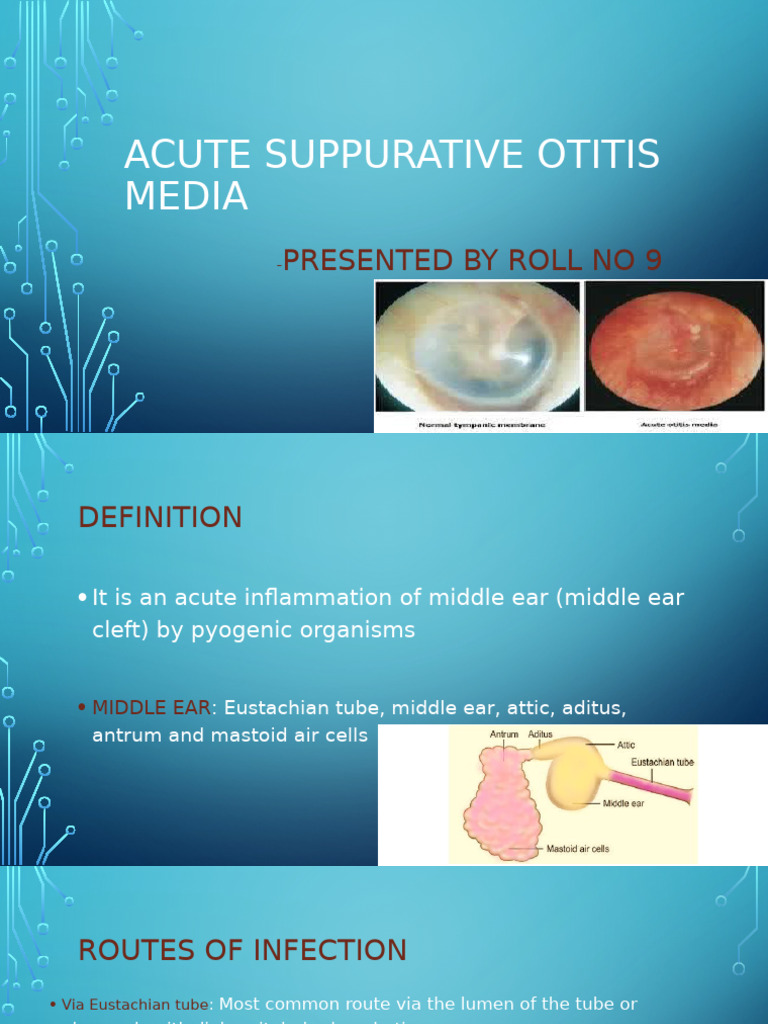 Acute Suppurative Otitis Media | PDF | Surgical Specialties | Auditory ...