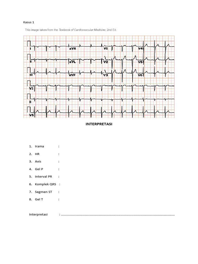 Ekg Ubungen Mit Losungen Pdf