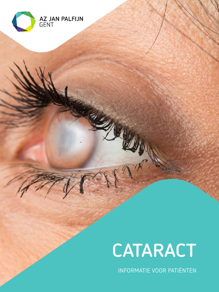 Cataract | PDF