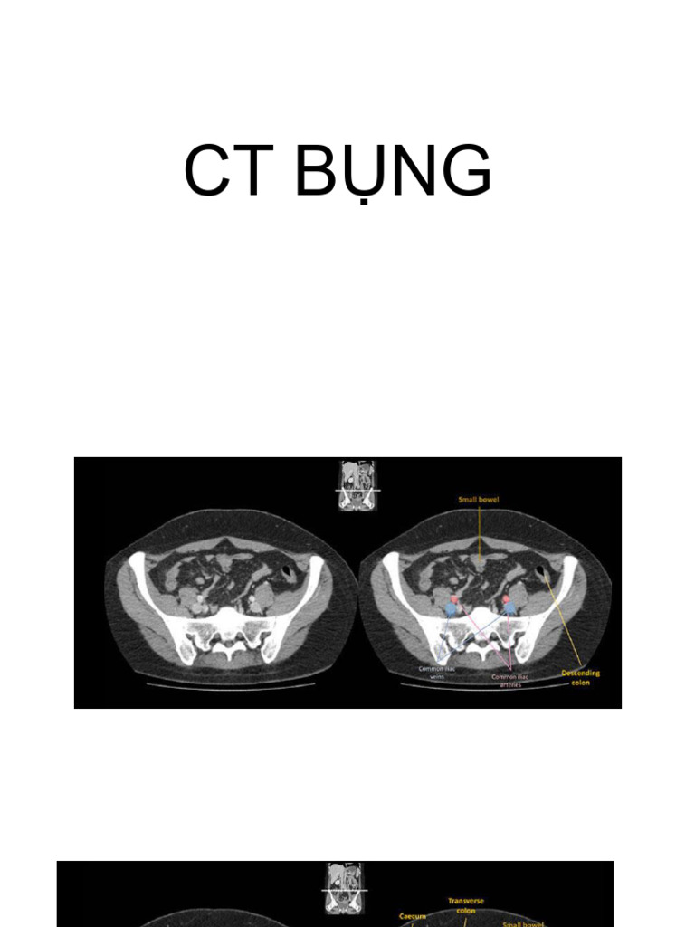 CT B NG | PDF