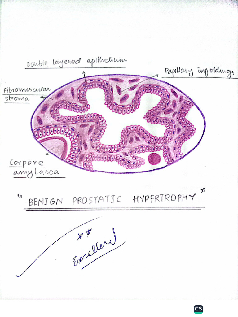 Histo Diagrams | PDF