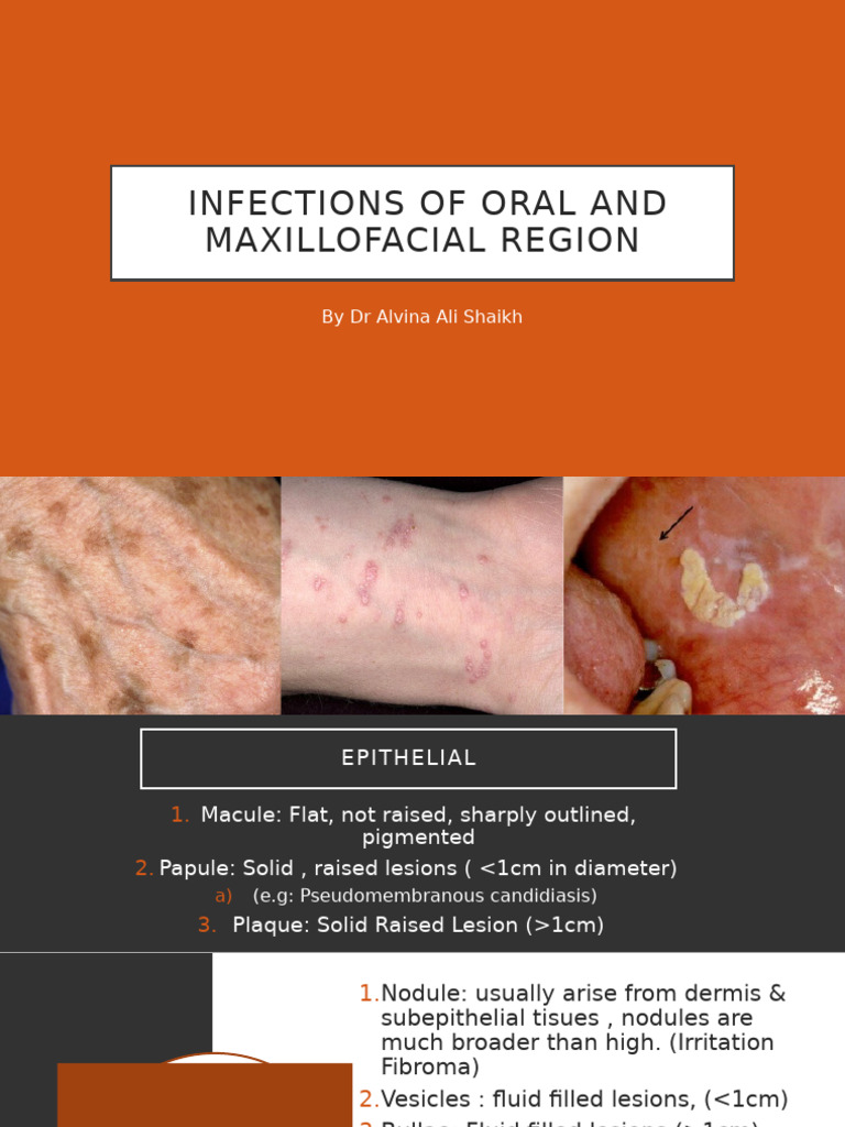 Maxillofacial Infections Overview | PDF | Infection | Measles