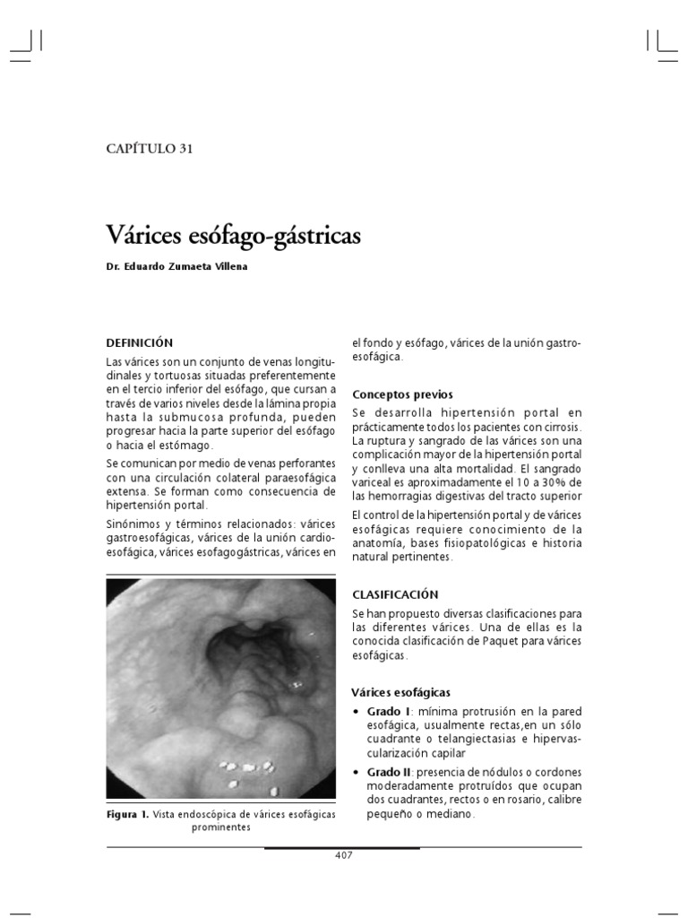 Cap31 Varices Esofago-Gastricas | PDF | Cirrosis | Estómago
