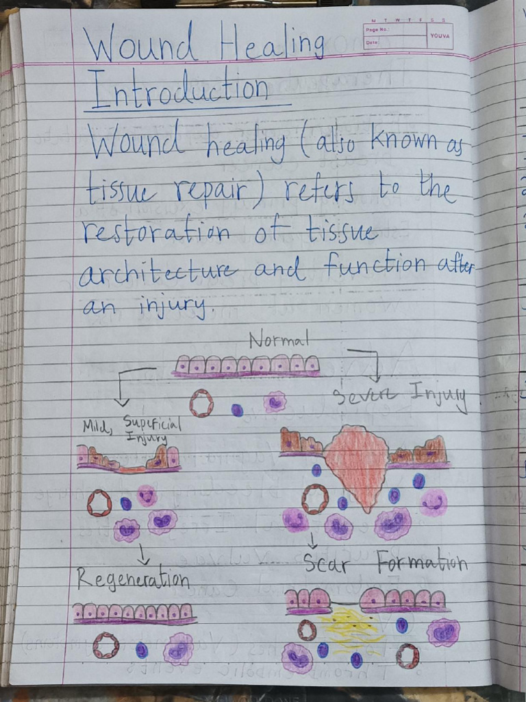 Paper A Pathology Final Sendup Wound Healing, Hodgkin Lymphoma | PDF
