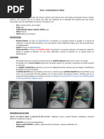 Signos radiológicos del hilio pulmonar | PDF | Pulmón | Corazón