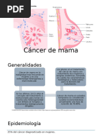 Fisiopatología y Clasificación Del Cáncer de Mama | PDF | Metástasis | Cáncer de mama