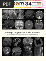 Manejo de Coprostasis en Pediatría | PDF | Recto | Diarrea