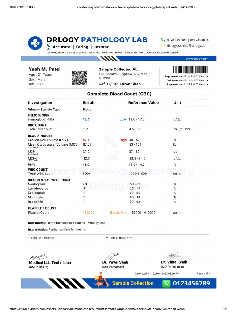 CBC Test Report Format Example Sample Template Drlogy Lab Report | PDF
