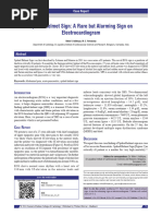 Azure XT DR Mri Surescan IFU | PDF | Artificial Cardiac Pacemaker ...