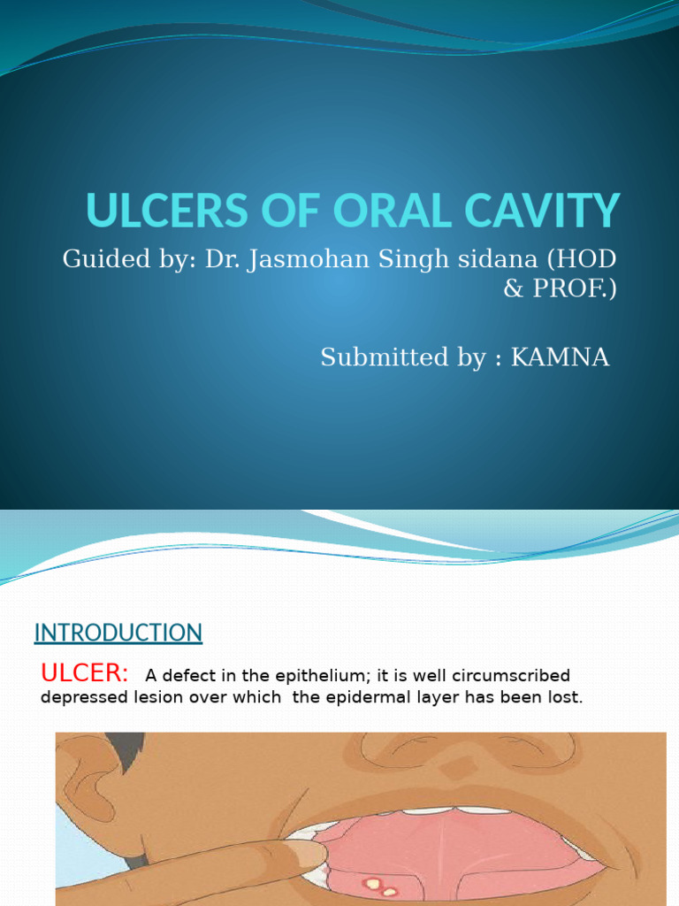 Oral Ulcers: Diagnosis and Types | PDF