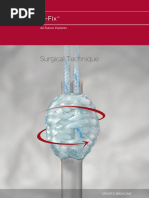 FiberStitch™ Meniscal Repair Technique | PDF | Surgical Suture ...