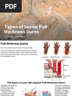 Understanding Burn Depths and Effects | PDF