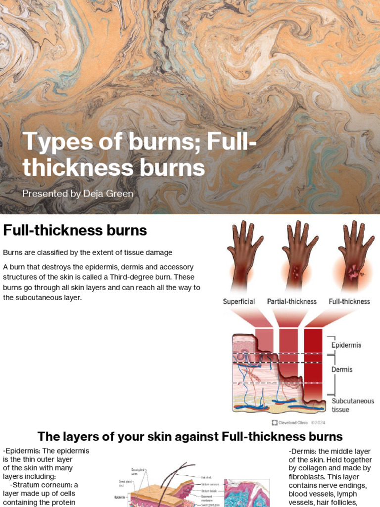 Understanding Full-Thickness Burns | PDF | Skin | Burn