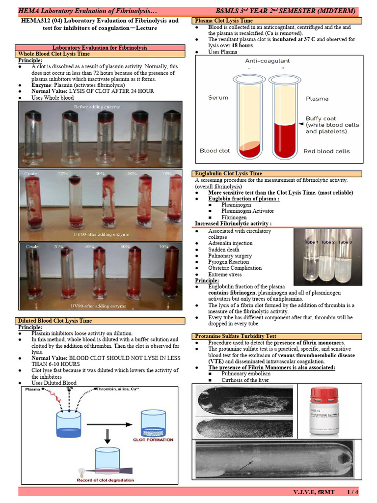 HEMA312 (04) Laboratory Evaluation of Fibrinolysis and Mixing Studies ...