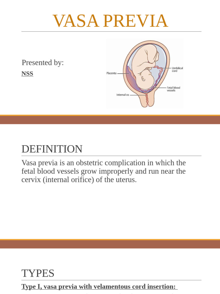Vasa Previa | PDF